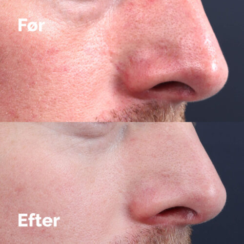 Øg din maskulinitet gennem kosmetiske behandlinger til mænd